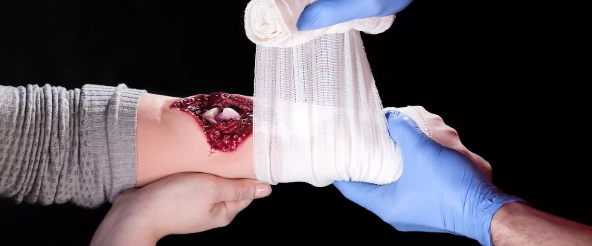 Is Serosanguineous Drainage Normal? Signs to Watch in Wound Care