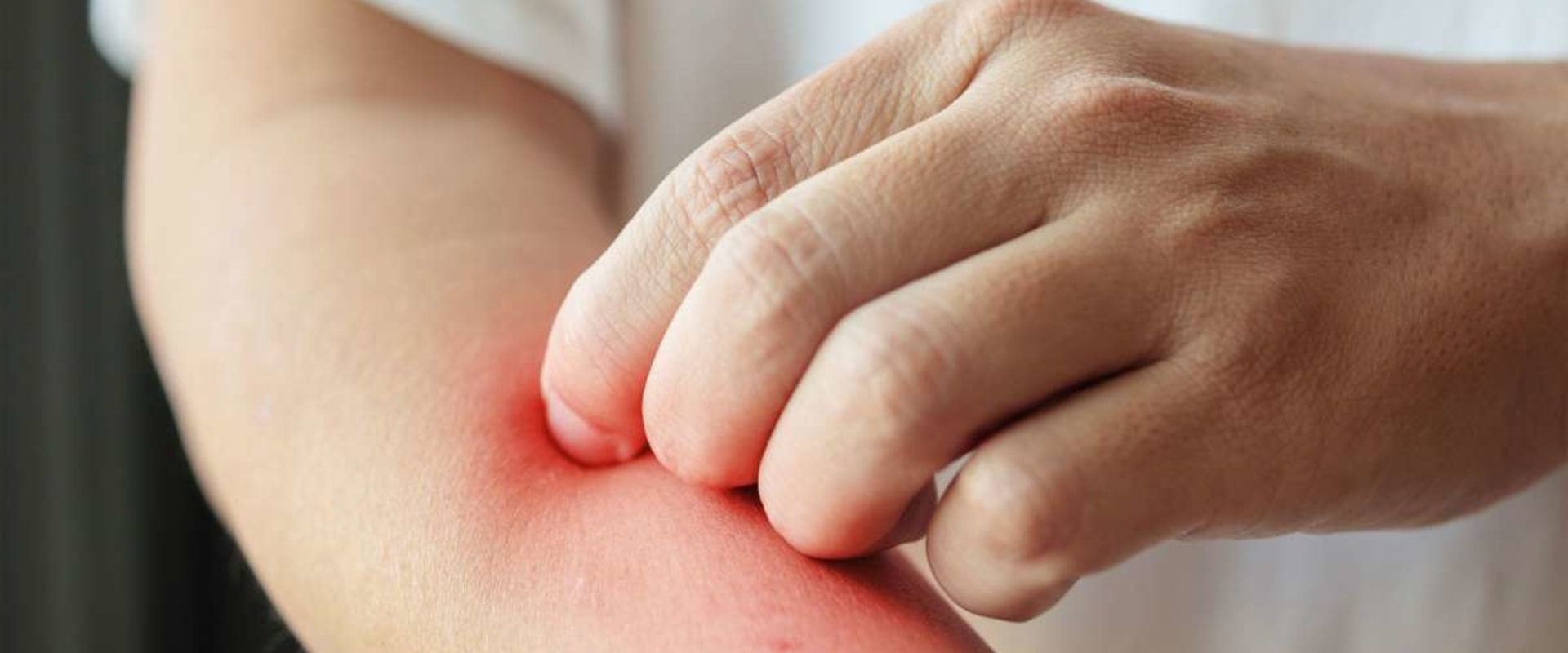 Is Itching a Sign of Healing? Everything You Need to Know About That ...