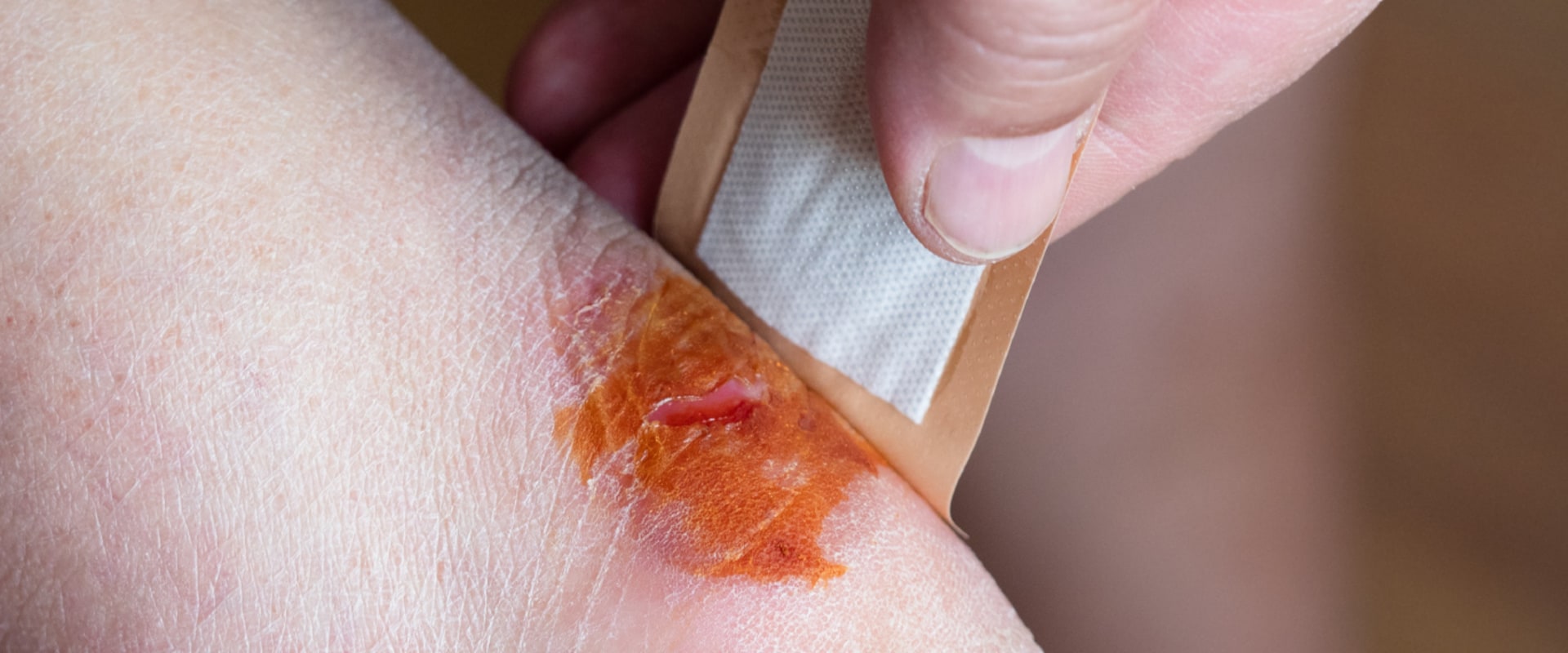 The Science Behind Wound Healing and the Best Options for Faster Recovery