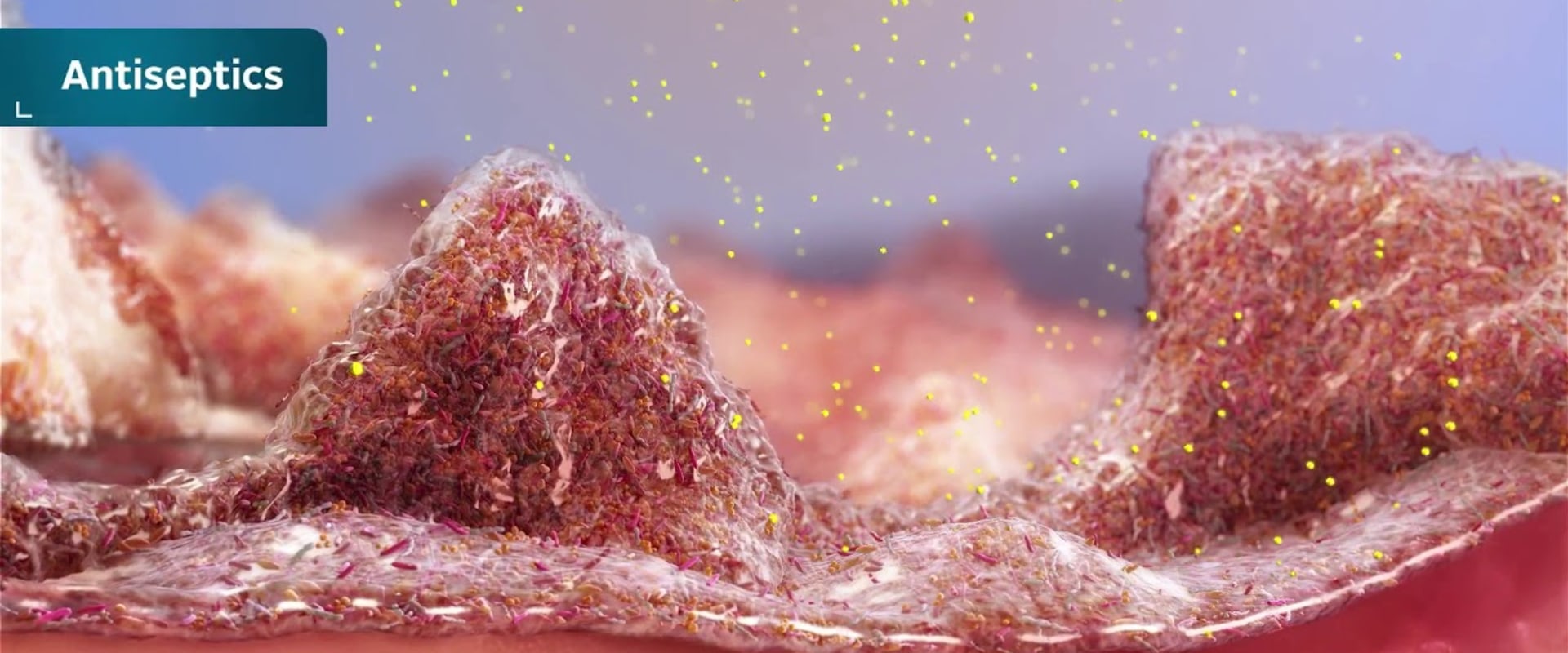 The Top Causes of Delayed Wound Healing: An Expert's Perspective